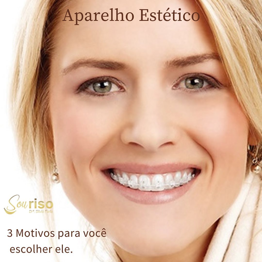 Aparelho Estético, 3 Motivos para você escolher ele - SouRiso - Dra ...